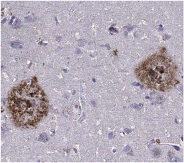 Anti-Amyloid Beta (ABeta) x-42 Antibody, clone 12F4 | 05-831-I